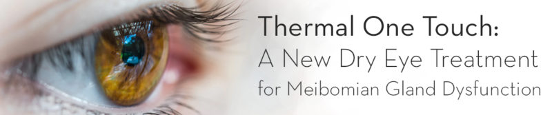 Thermal One Touch: A New Dry Eye Treatment for Meibomian Gland Dysfunction