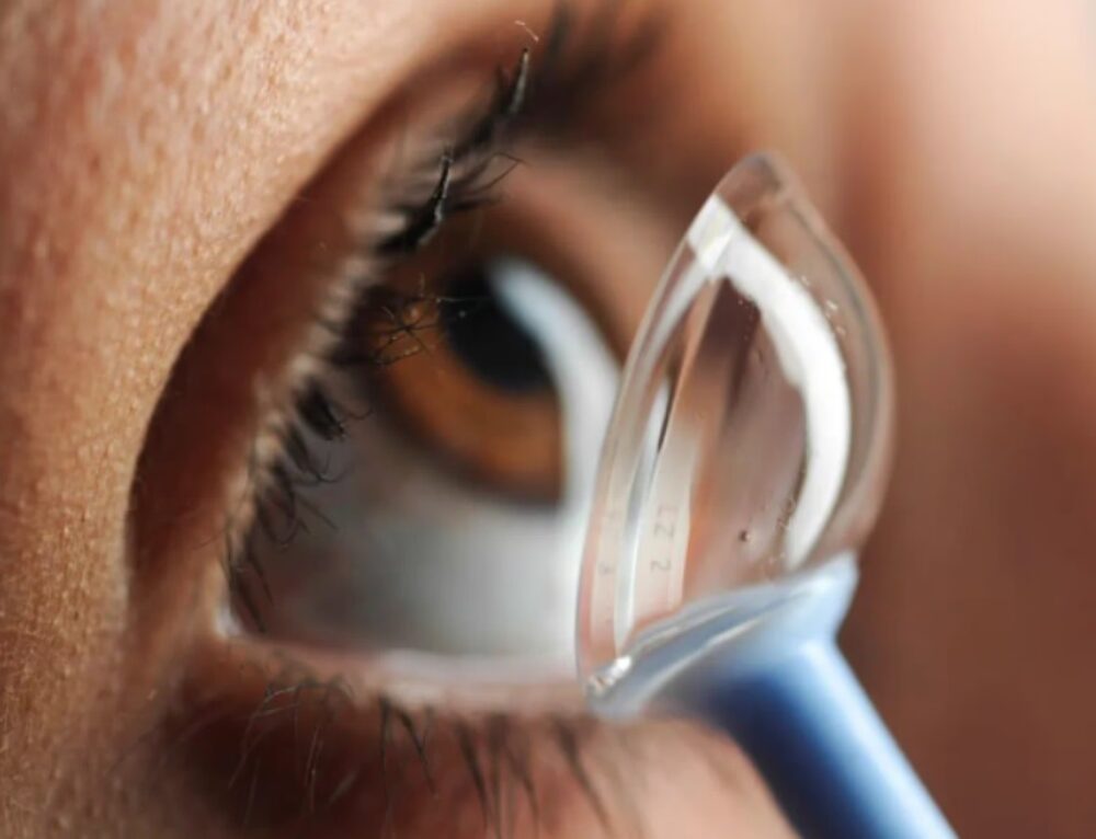 Thermal One Touch: New Dry Eye Treatment for MGD